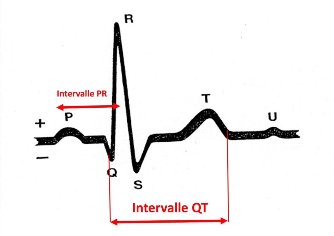 Cœur, hydroxychloroquine et coronavirus – Club Cœur et Santé de Saint-Dié