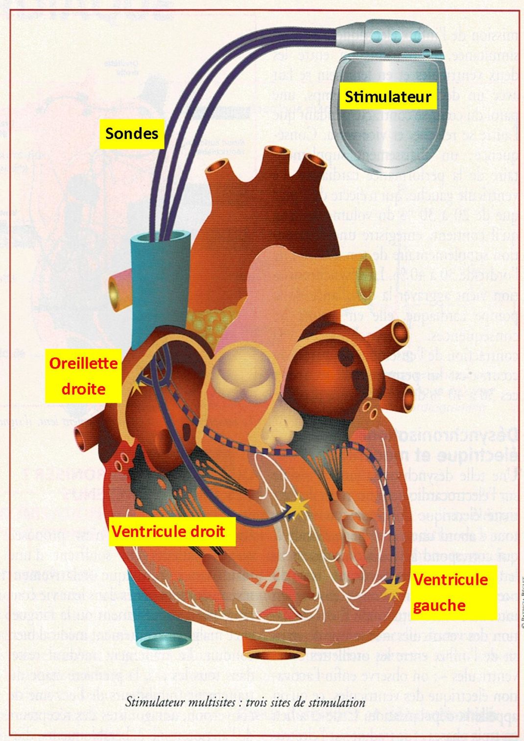 40 ans de progrès en cardiologie. Chapitre 3 : maladies des valves ...